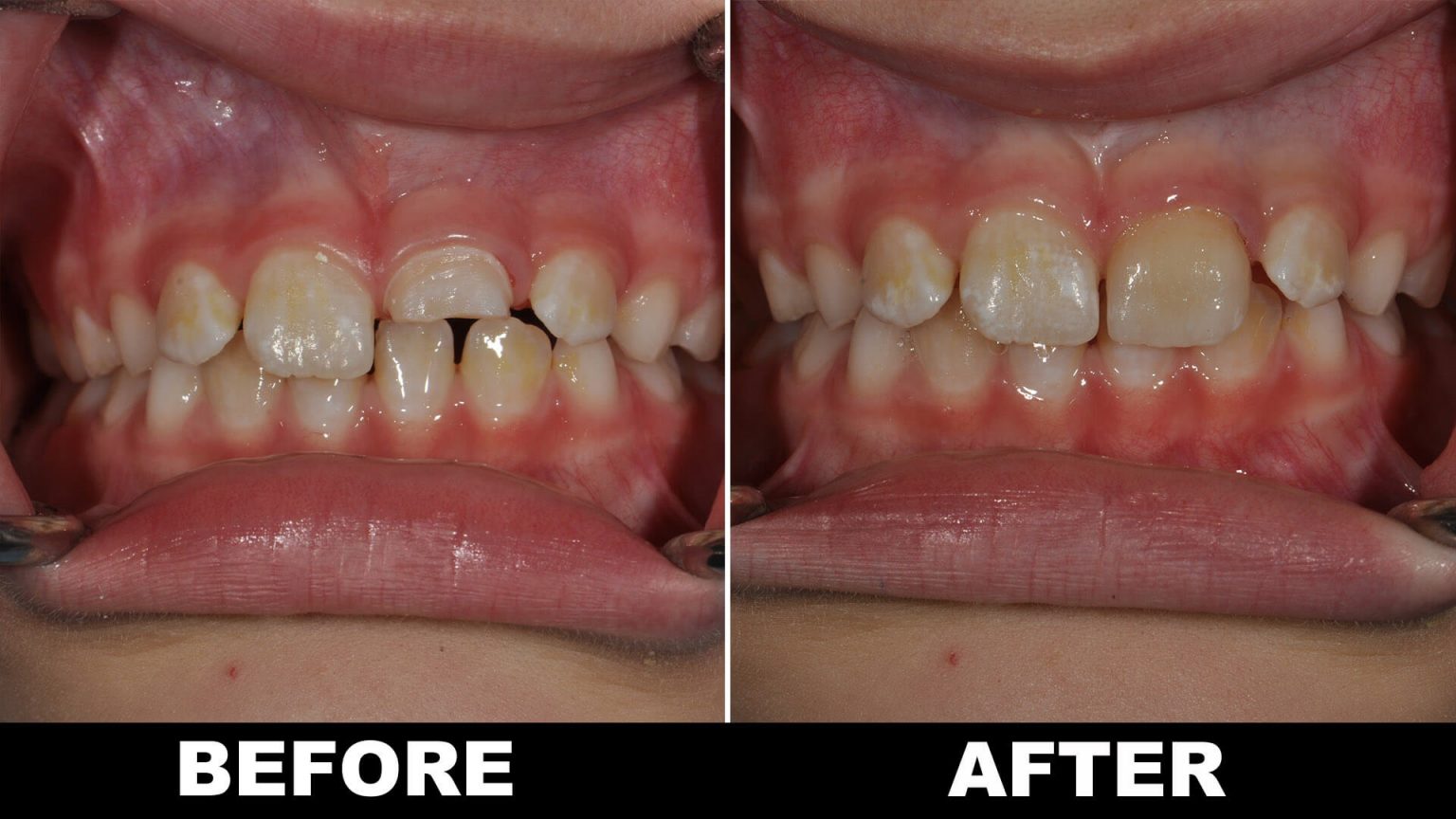 Guarding Your Smile: Understanding Dental Trauma - Cosmetic Dentist ...